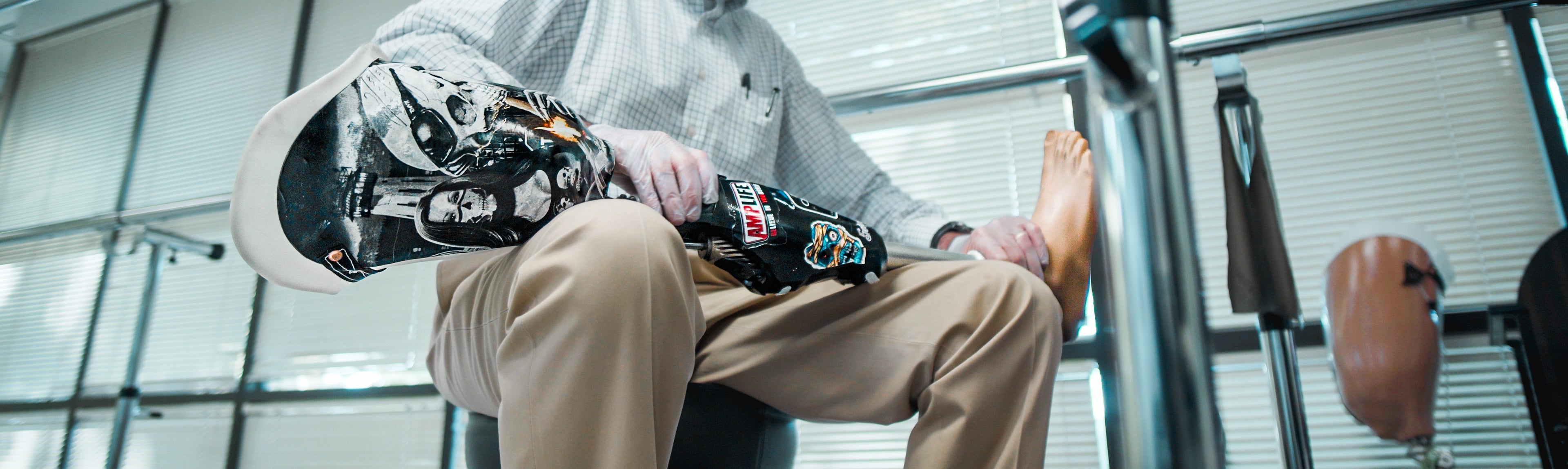 Prosthetic Solutions | Homepage — Amplife®