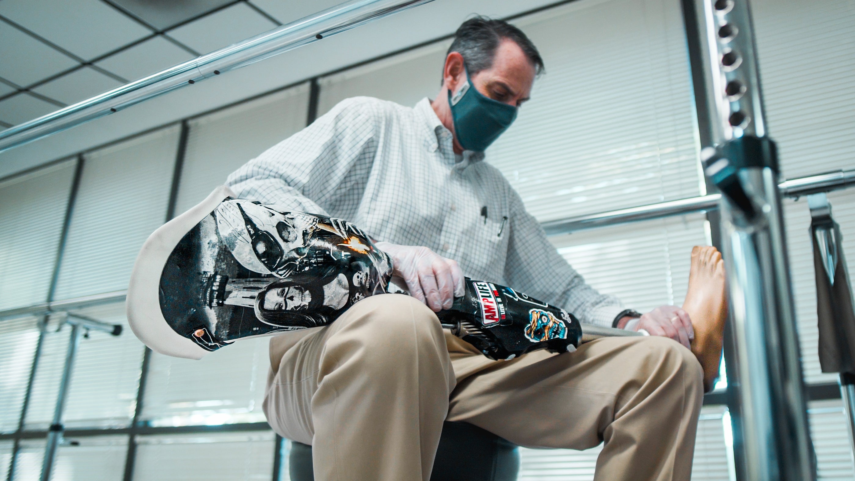 Prosthetic Solutions Prosthetic Services | Hollister, CA — Amplife®